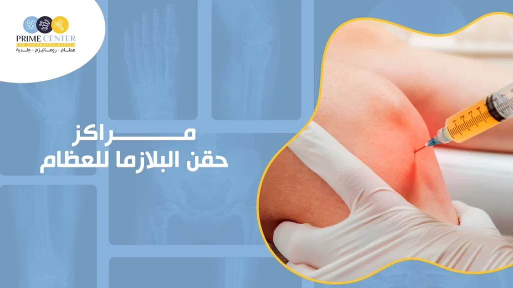 إليك فوائد وأضرار حقن البلازما للركبه بالتفصيل| مركز برايم